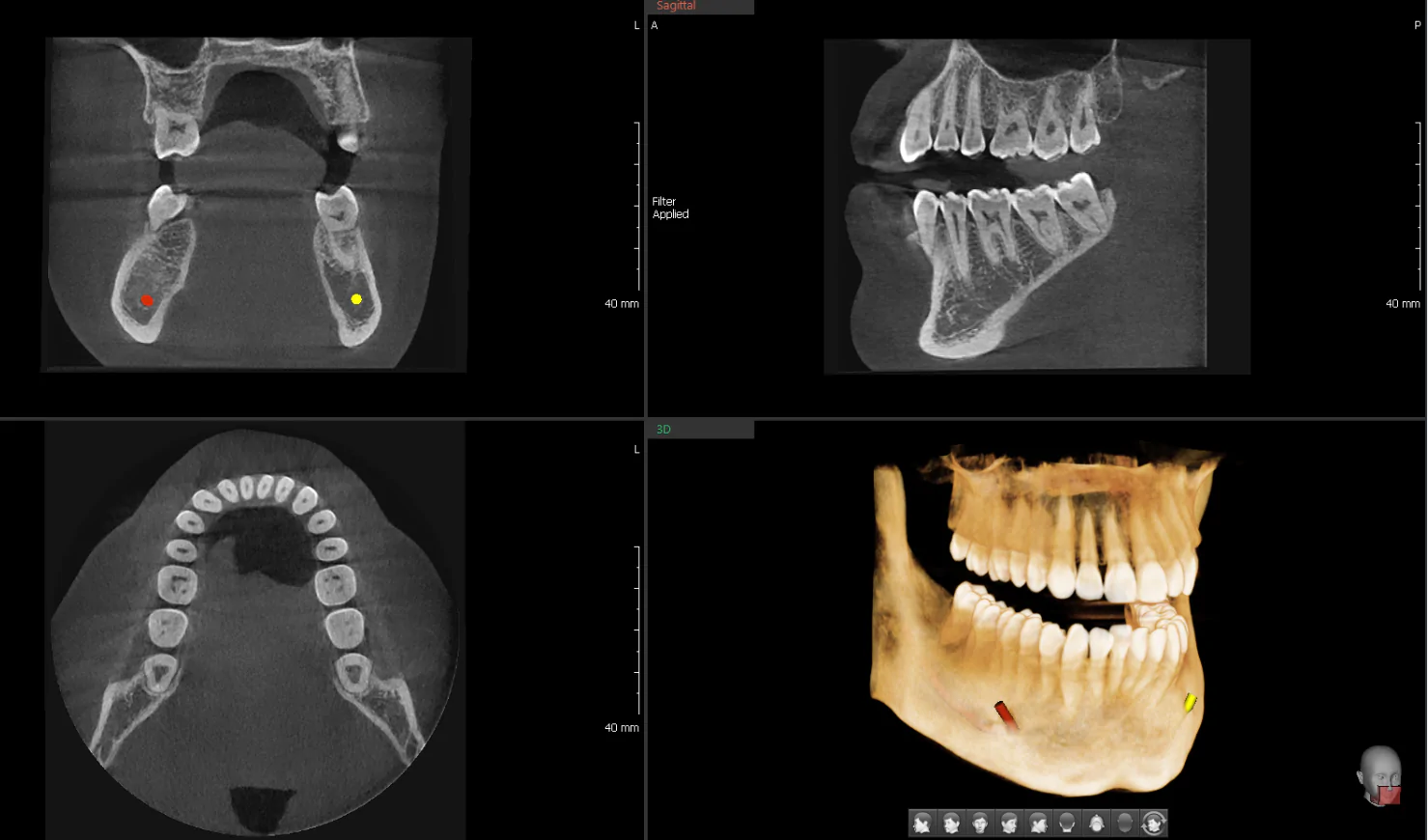 Scanxperts : Center for Dental, Head & Neck and ENT Imaging